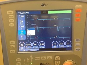 Viasys Avea Ventilator - iFixit