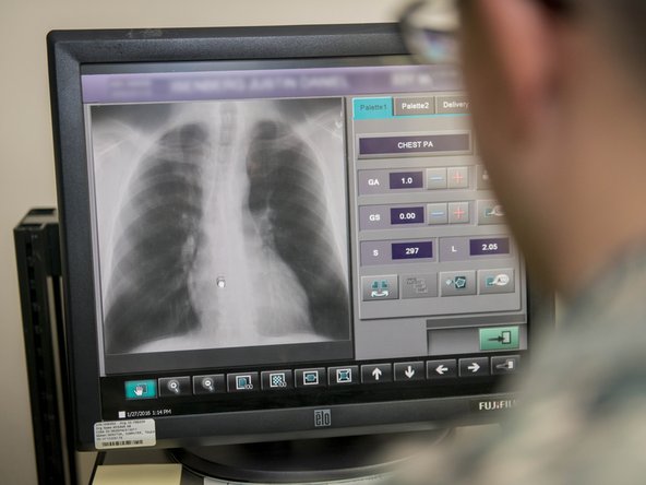 X-Ray Displays Repair - iFixit