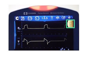 Puritan Bennett 980 Repair - iFixit